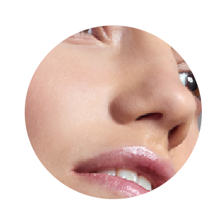 Nose Thread Lift - Price & Review Guide (2025) - Bio Aesthetic