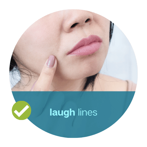Anti Aging Treatment Singapore - Price & Treatment - Bio Aesthetic