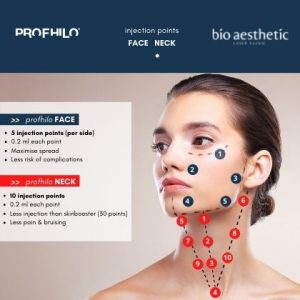 Profhilo Singapore: Benefits, Price and Side Effects (2025)