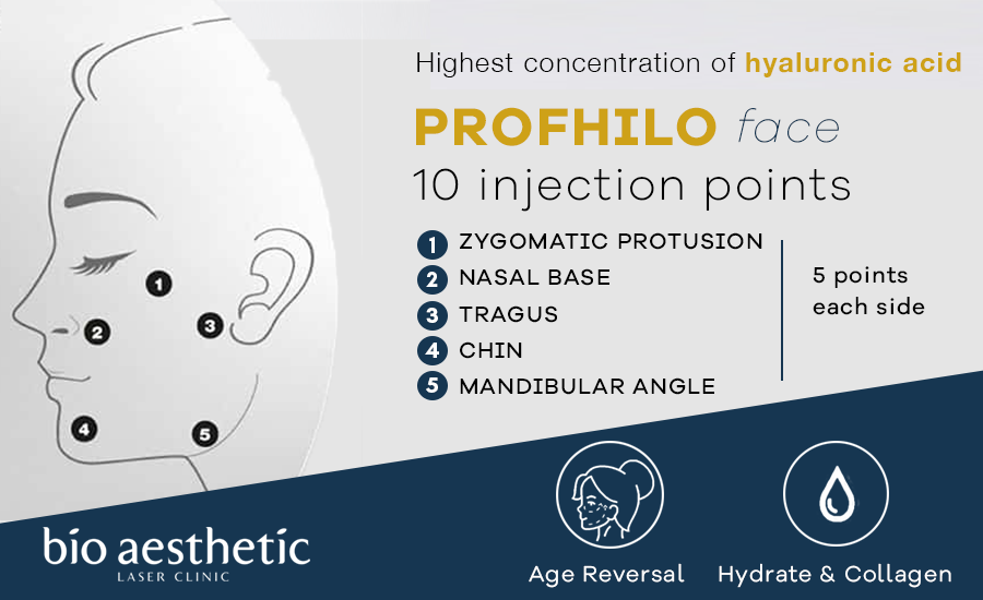 Profhilo Singapore: Benefits, Price and Side Effects Guide (2024)