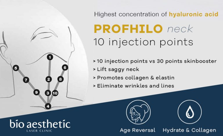 Profhilo Singapore: Benefits, Price and Side Effects Guide (2024)