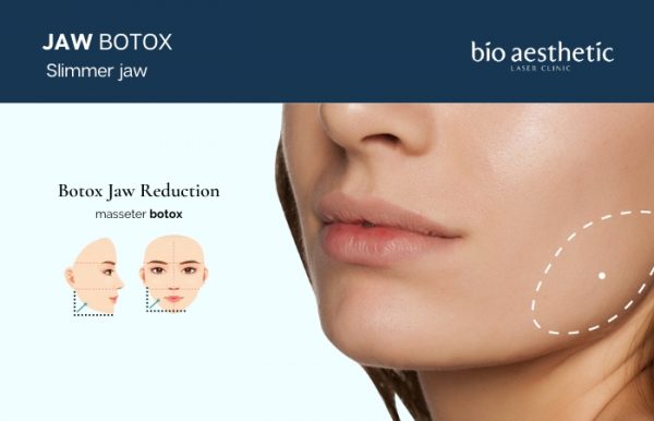 Jaw Botox (Masseter) : Benefits, Price and Side Effects (2025)
