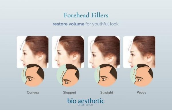 Forehead Filler: Price, Review & Side Effects (2025) - Bio Aesthetic