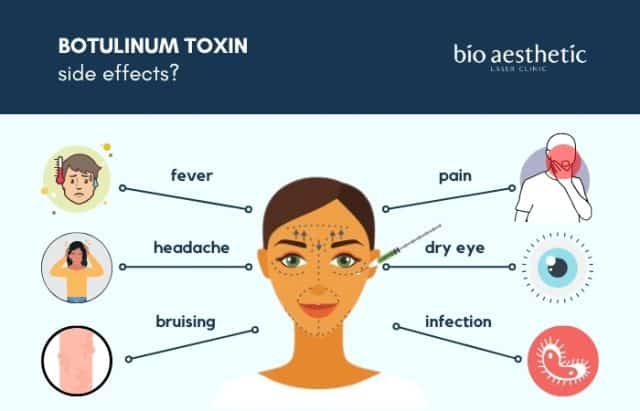 Botox Side Effect Guide | Singapore Evidence-Based Overview