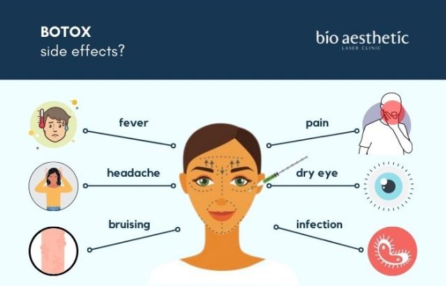 Botox Side Effect Guide | Singapore Evidence-Based Overview