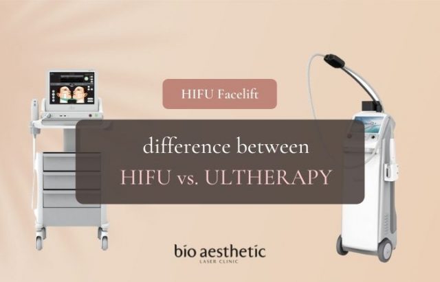 HIFU vs Ultherapy - HIFU Guide and Review - Bio Aesthetic