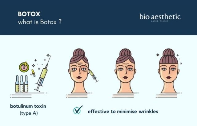 Botox Side Effects - What is Botox? Safety, Warning - Bio Aesthetic
