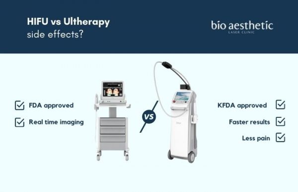HIFU vs Ultherapy - HIFU Guide and Review - Bio Aesthetic