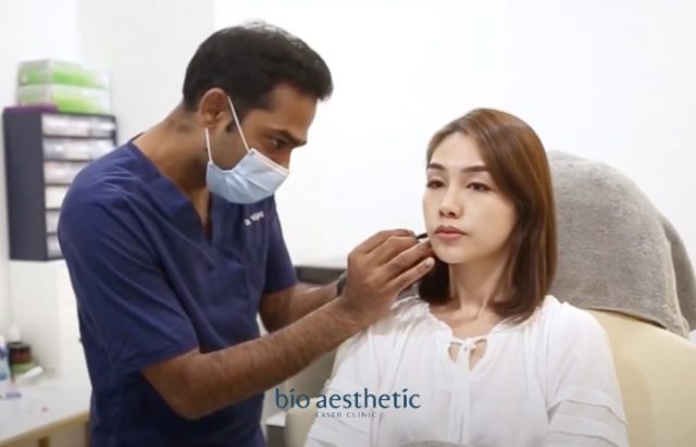 HIFU Treatment Costs in Singapore: What You Need to Know (2024 Guide) - Bio Aesthetic Clinic