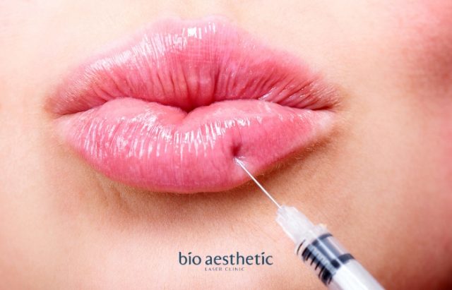 Post-Filler Care: Essential Tips for Optimal Lip Filler Aftercare